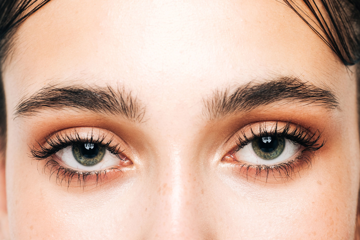 uneven eyebrows surgery